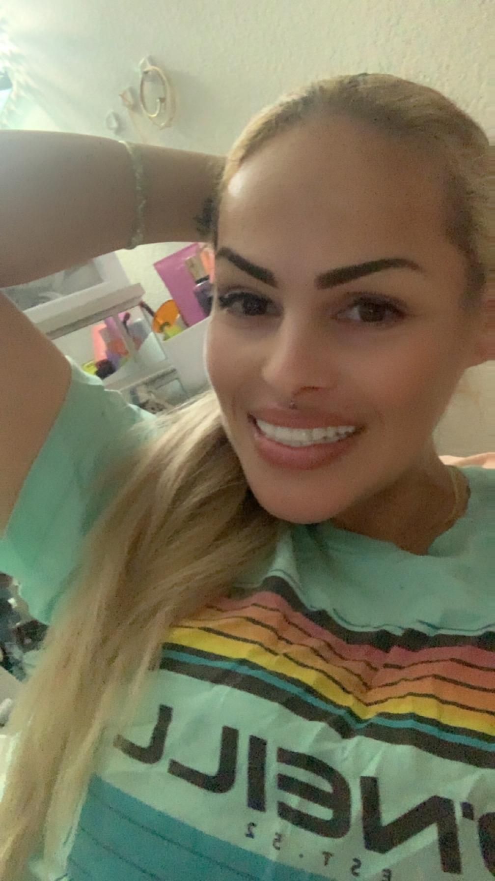 Landing Page 1 | Shiny Smile Veneers